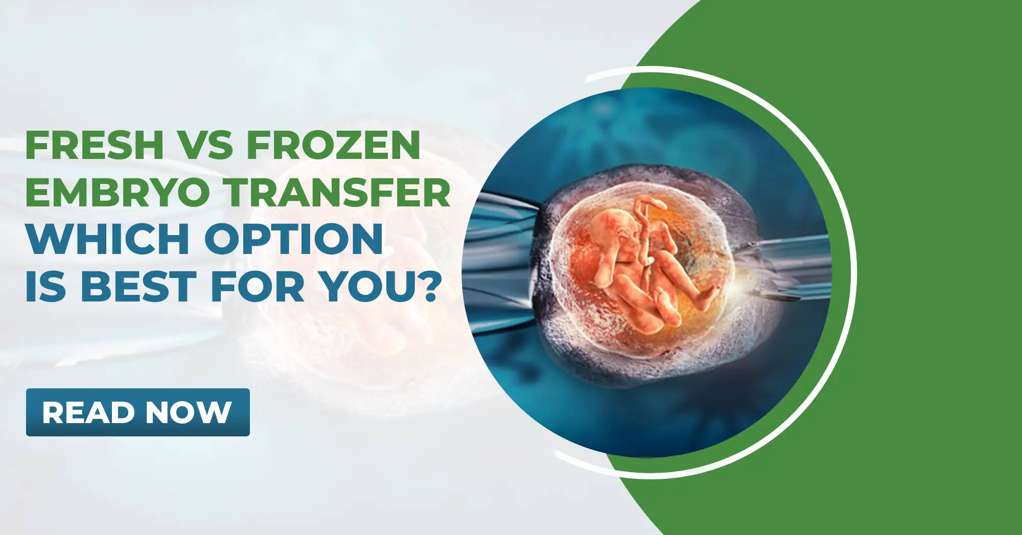 Fresh vs Frozen Embryo Transfer: Which Option is Best for You?